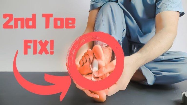 Capsulitis of the Second Toe Taping #1 - Balance Foot & Ankle